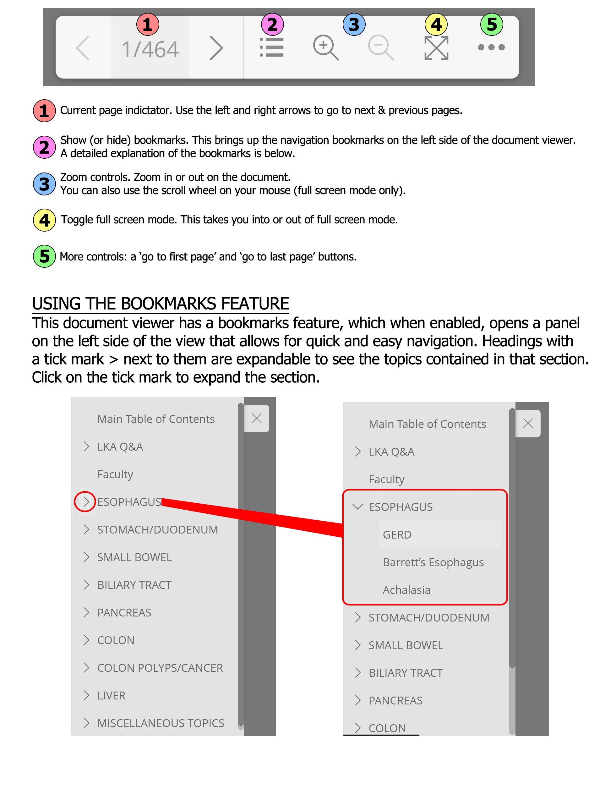 LKA Primer - The William M. Steinberg Board Review in Gastroenterology ...